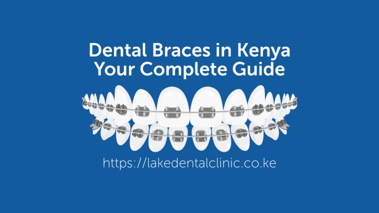 Dental braces in Kenya; your complete guide – Lake Dental Clinic
